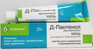 Потница у взрослых. Фото, симптомы и лечение на руках, теле, лице, шее ...